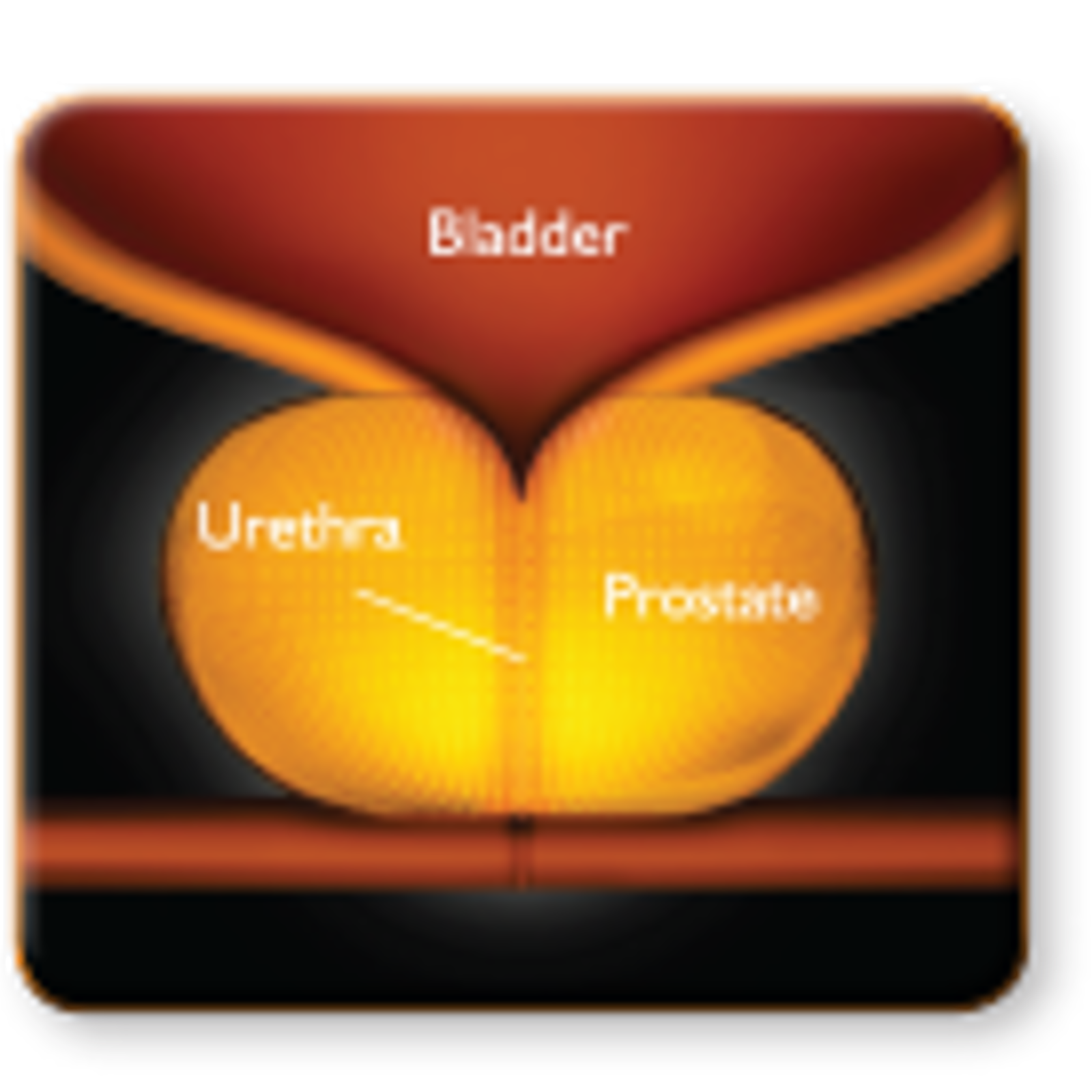 Urolift System | Urology Associates of Idaho Falls
